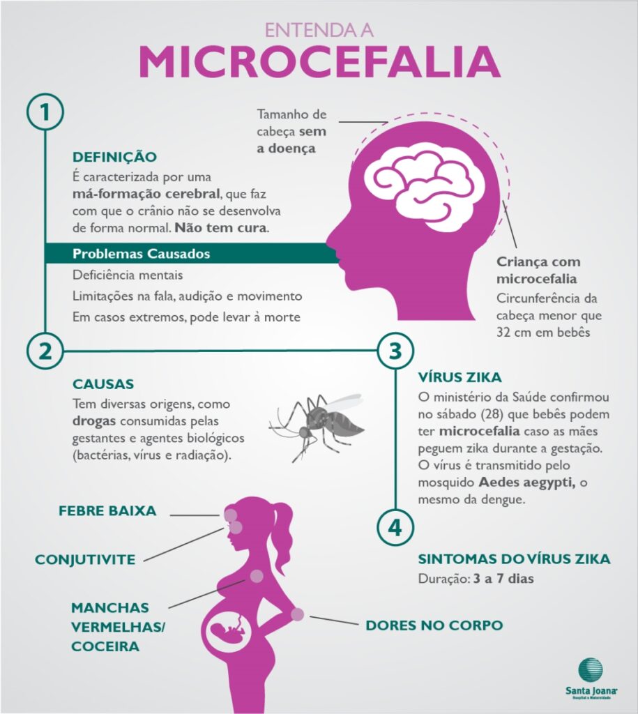 Microcefalia e Zika Vírus - Hospital e Maternidade Santa Joana
